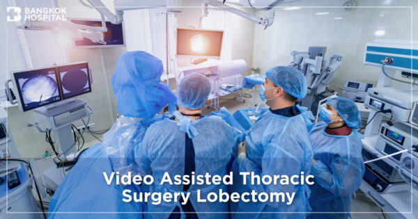 Video Assisted Thoracic Surgery Lobectomy – The New Surgical Technique ...